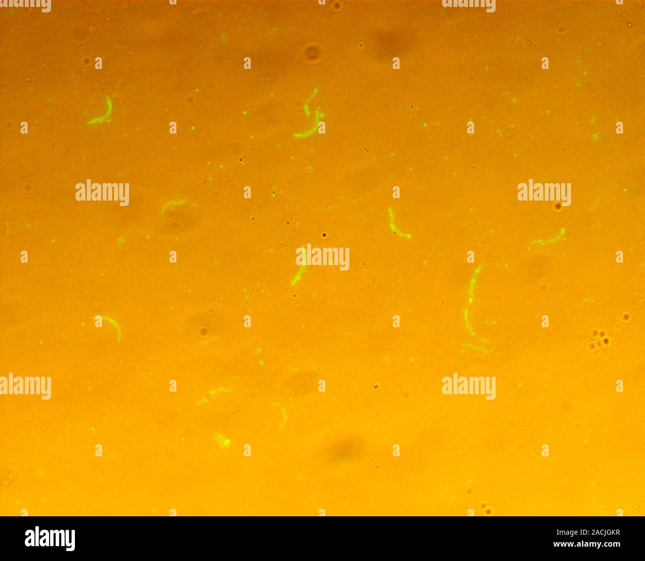 Malaria vaccine research. Light micrograph of sporozoites from the ...