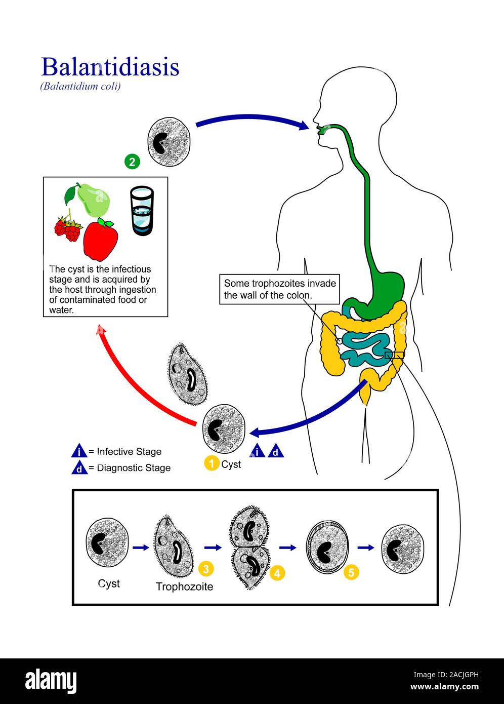 Balantidium Coli Diagram