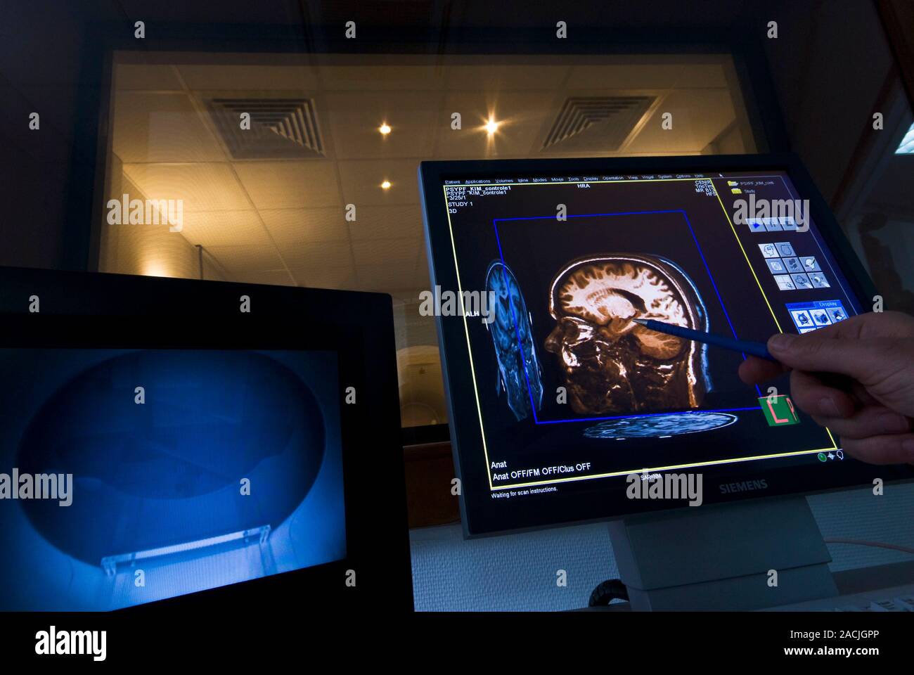 MRI scan. MRI operator looking at scans of a patient's brain Stock ...