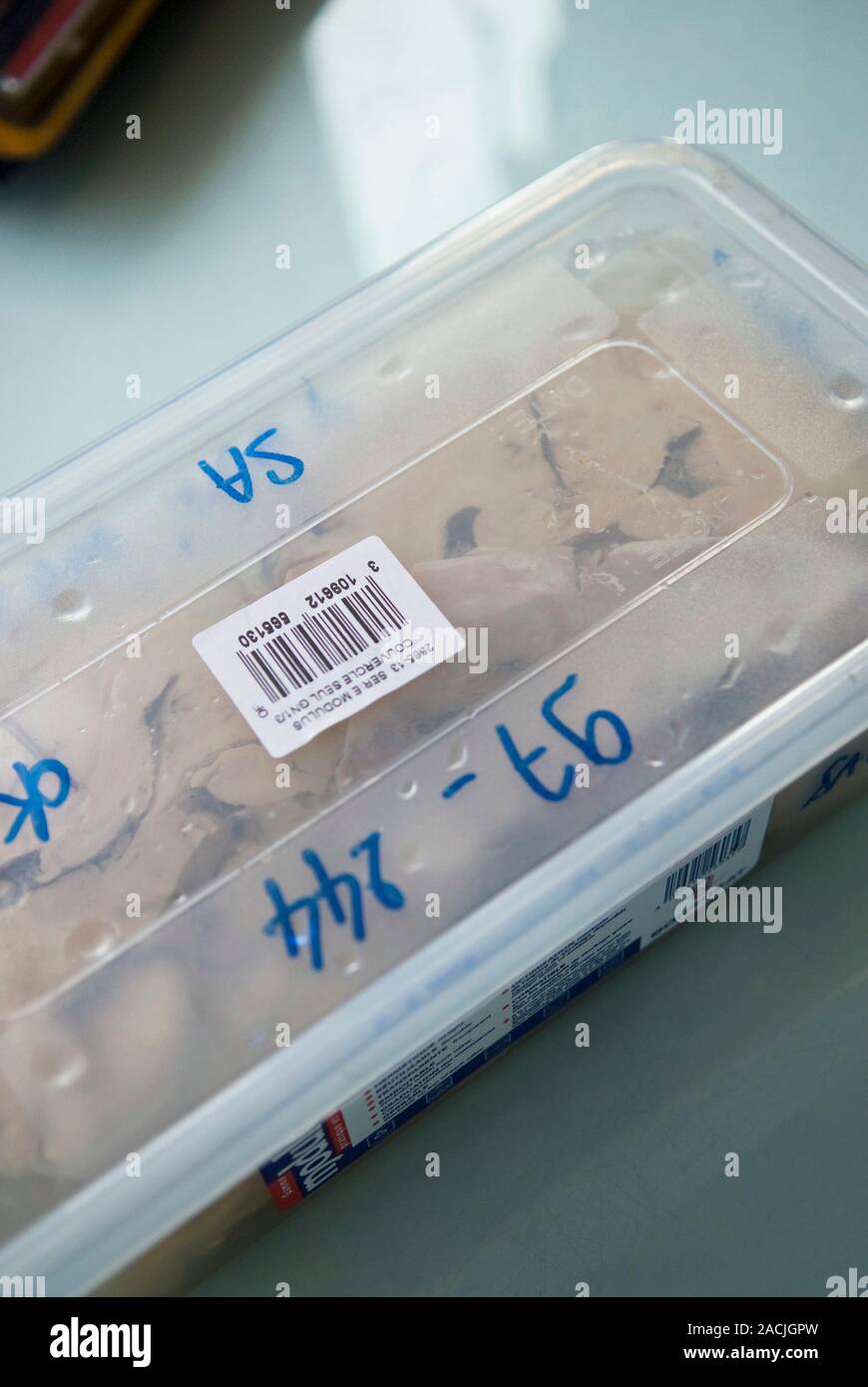 Neuropathology lab. Samples of brain tissue for sampling and analysis ...