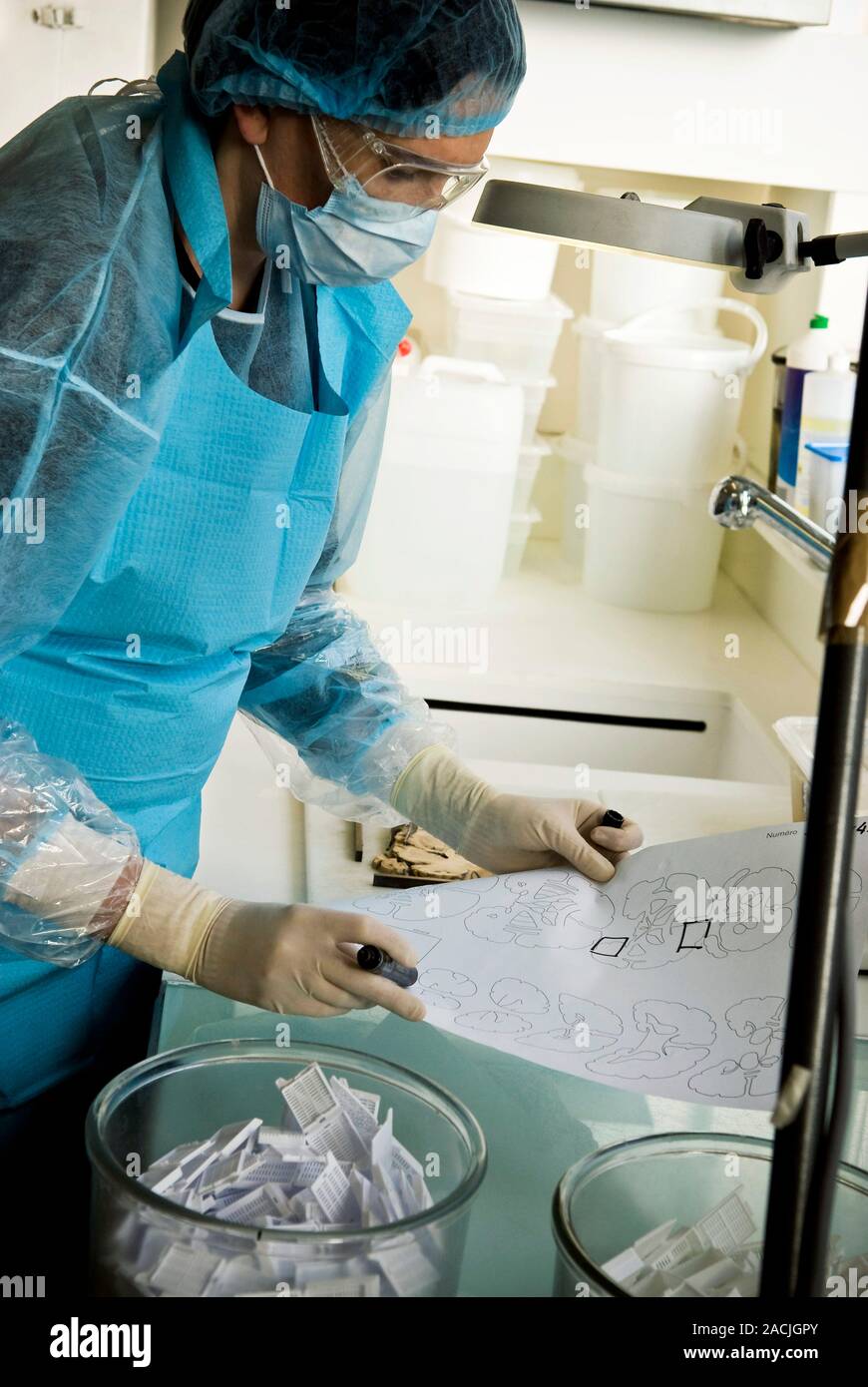 Neuropathology lab. Pathologist collecting a tissue sample from a brain ...