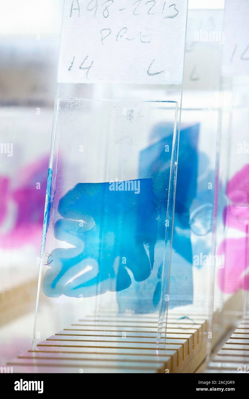 Neuropathology lab. Slides prepared with samples of brain tissue ...