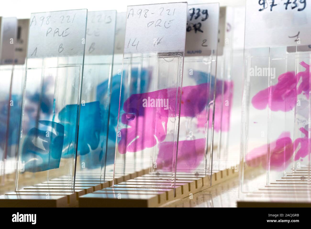Neuropathology lab. Slides prepared with samples of brain tissue ...