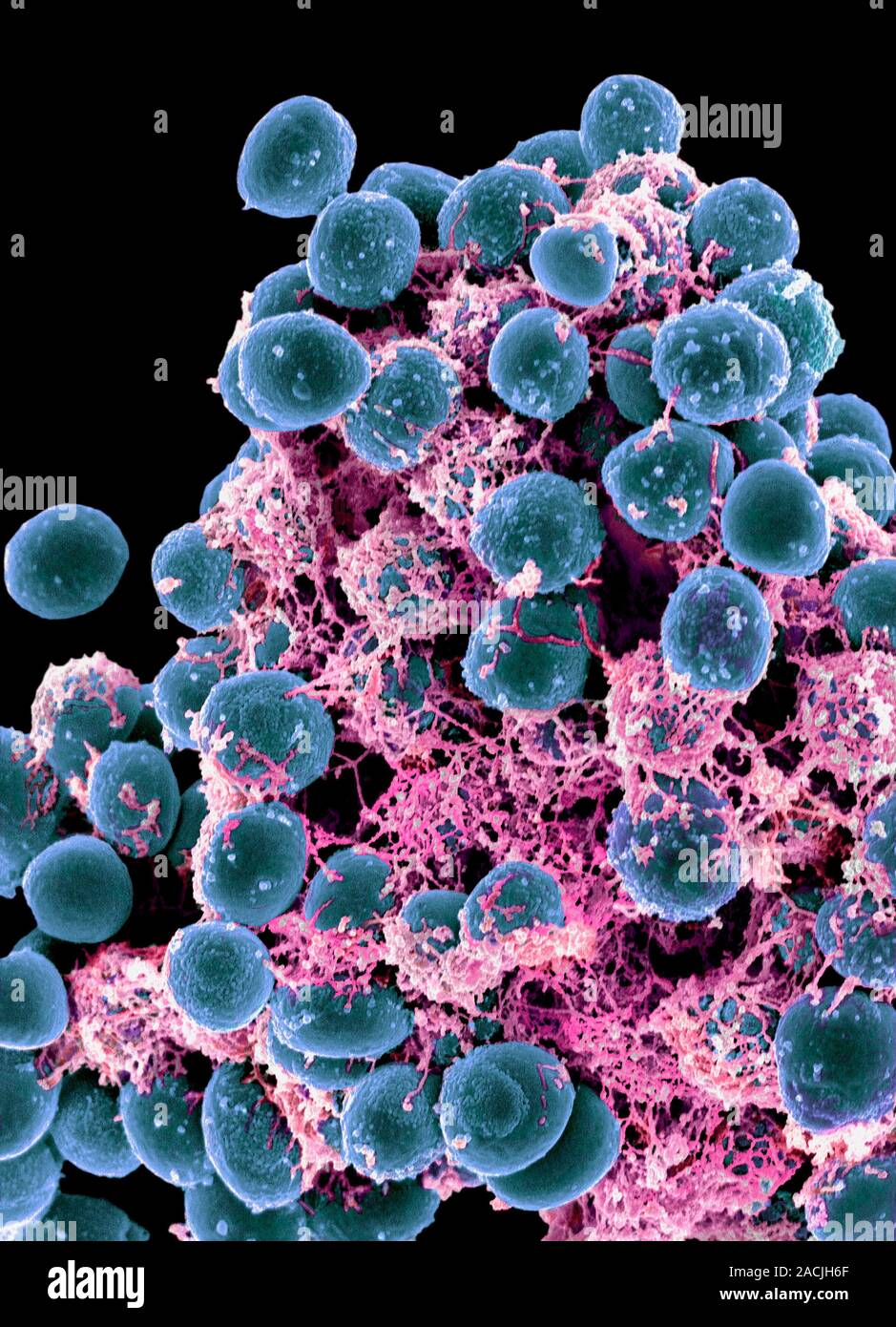 Staphylococcus Epidermidis Coloured Scanning Electron Micrograph Sem Of Staphylococcus