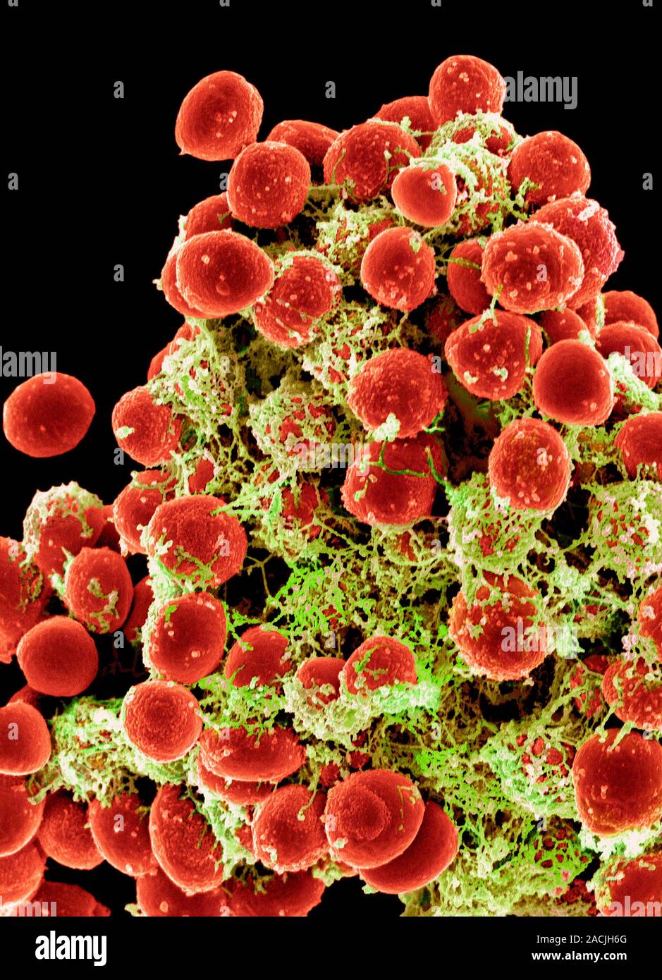 Staphylococcus epidermidis. Coloured scanning electron micrograph (SEM ...