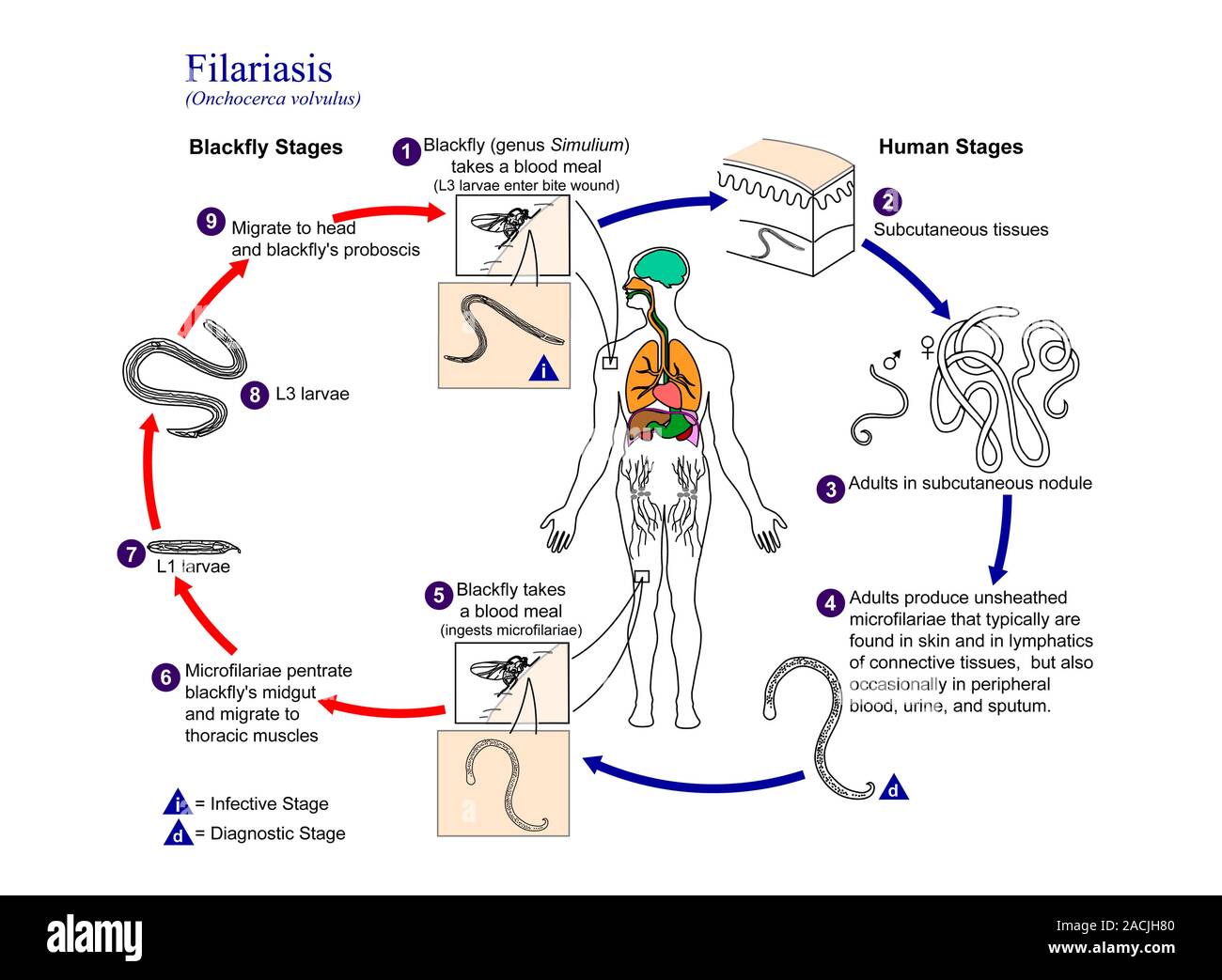 River blindness life cycle. Diagram showing the life cycle of the ...