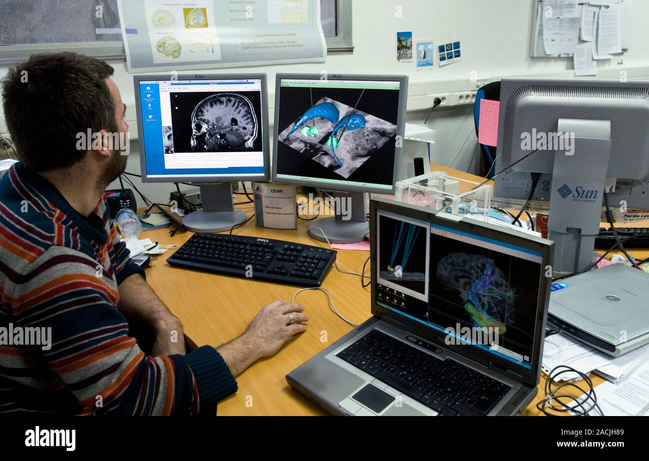 Neuroimaging research centre. Researcher examining MRI scans of a ...