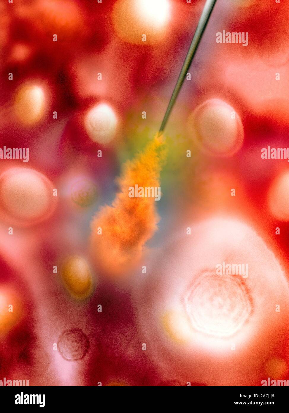 Syringe needle injection. Close-up of a syringe needle being used to ...