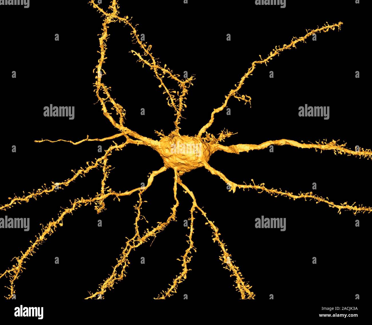 Brain neuron. Computer reconstruction of a medium spiny neuron from the ...
