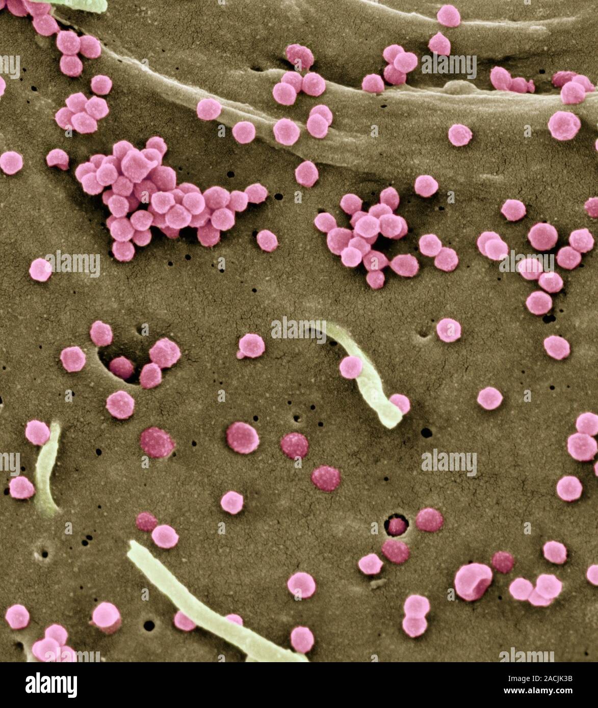 Cell infected with HIV. Coloured scanning electron micrograph (SEM) of ...