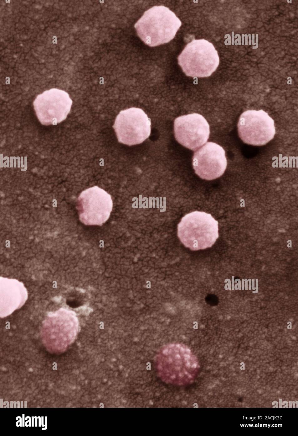 Cell infected with HIV. Coloured scanning electron micrograph (SEM) of ...