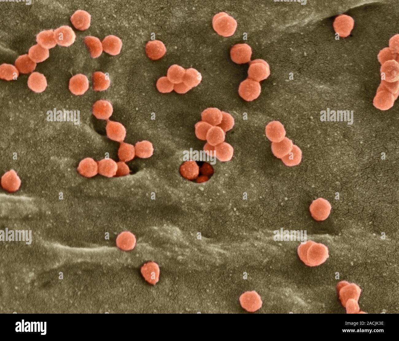Cell infected with HIV. Coloured scanning electron micrograph (SEM) of ...