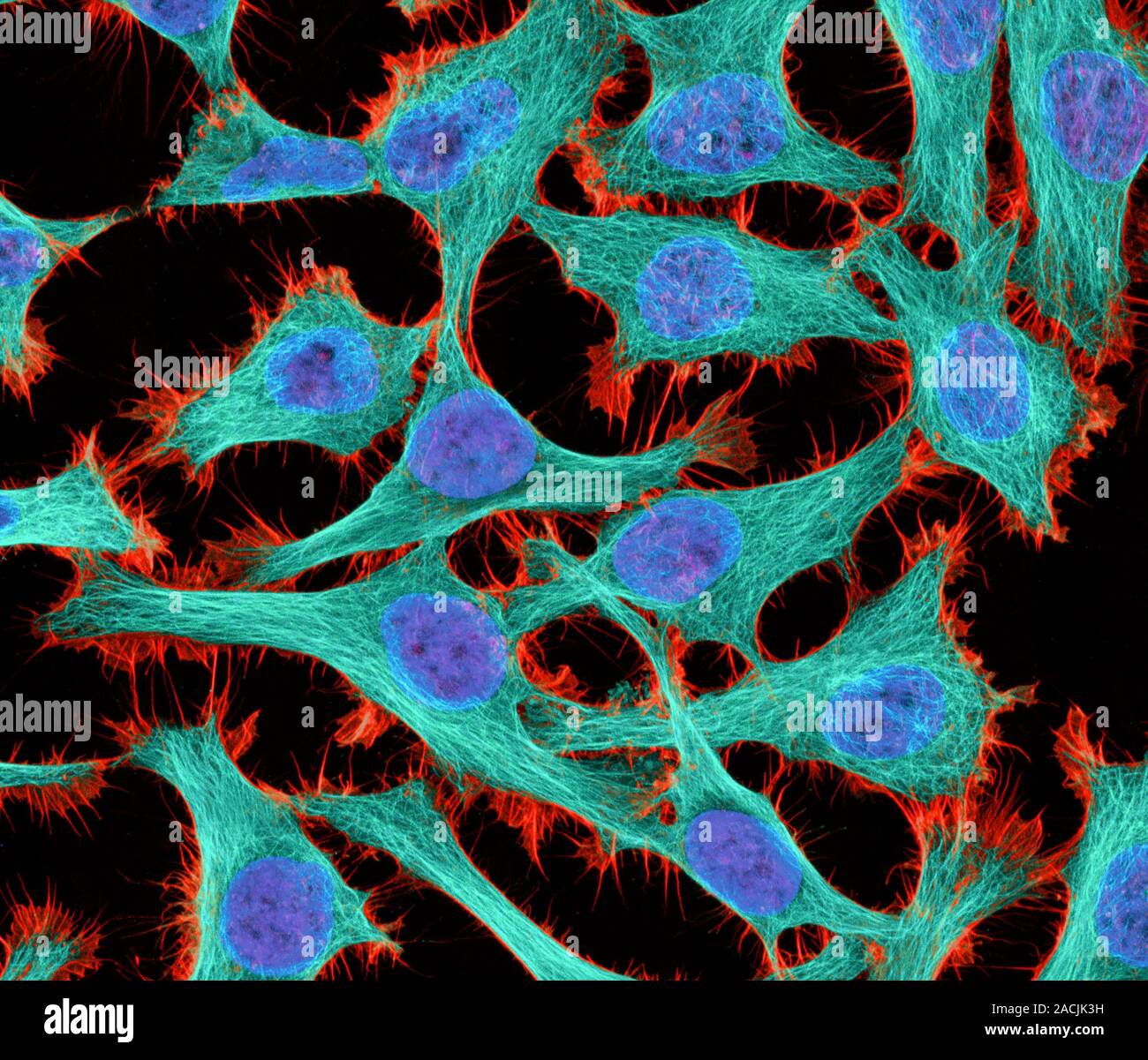 HeLa cells, fluorescence light micrograph. The cell nuclei, which ...