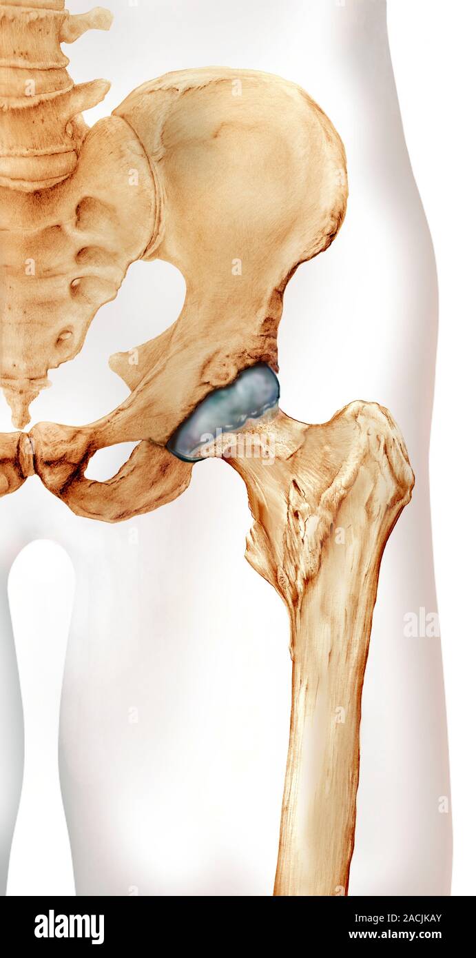 Healthy hip. Artwork showing half of a pelvis. Part of the sacrum ...
