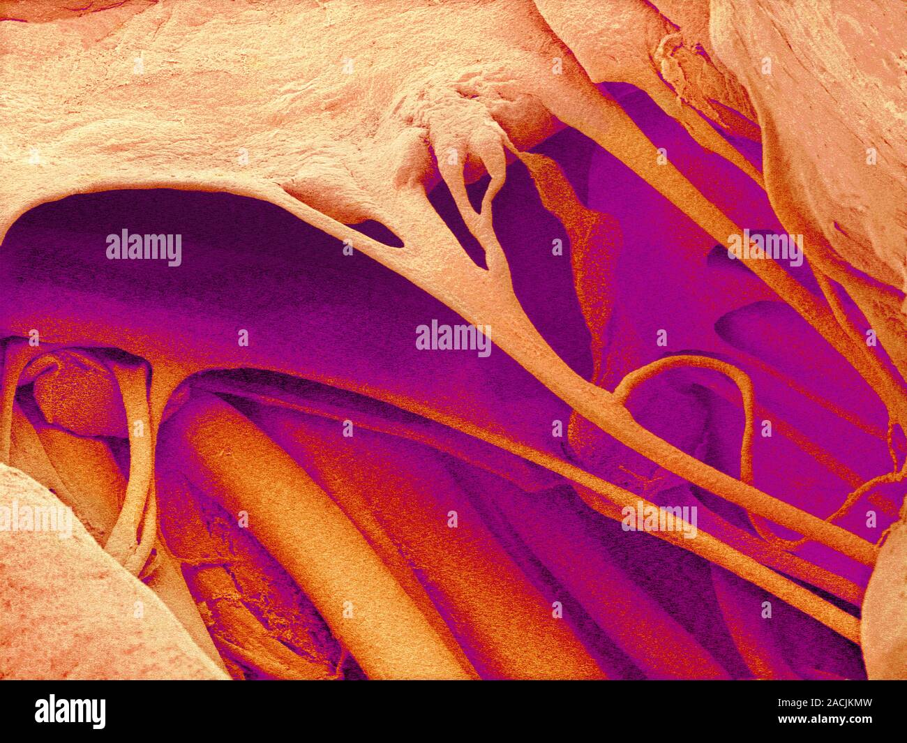 Heart valve and strings, coloured scanning electron micrograph (SEM ...