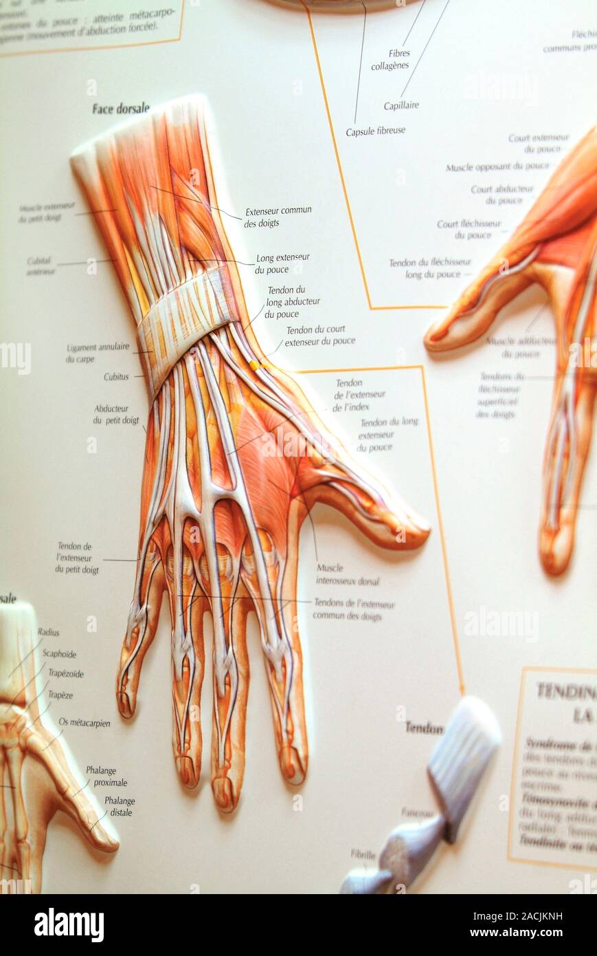 Hand anatomy. Wall display in a hospital, showing the muscles and ...