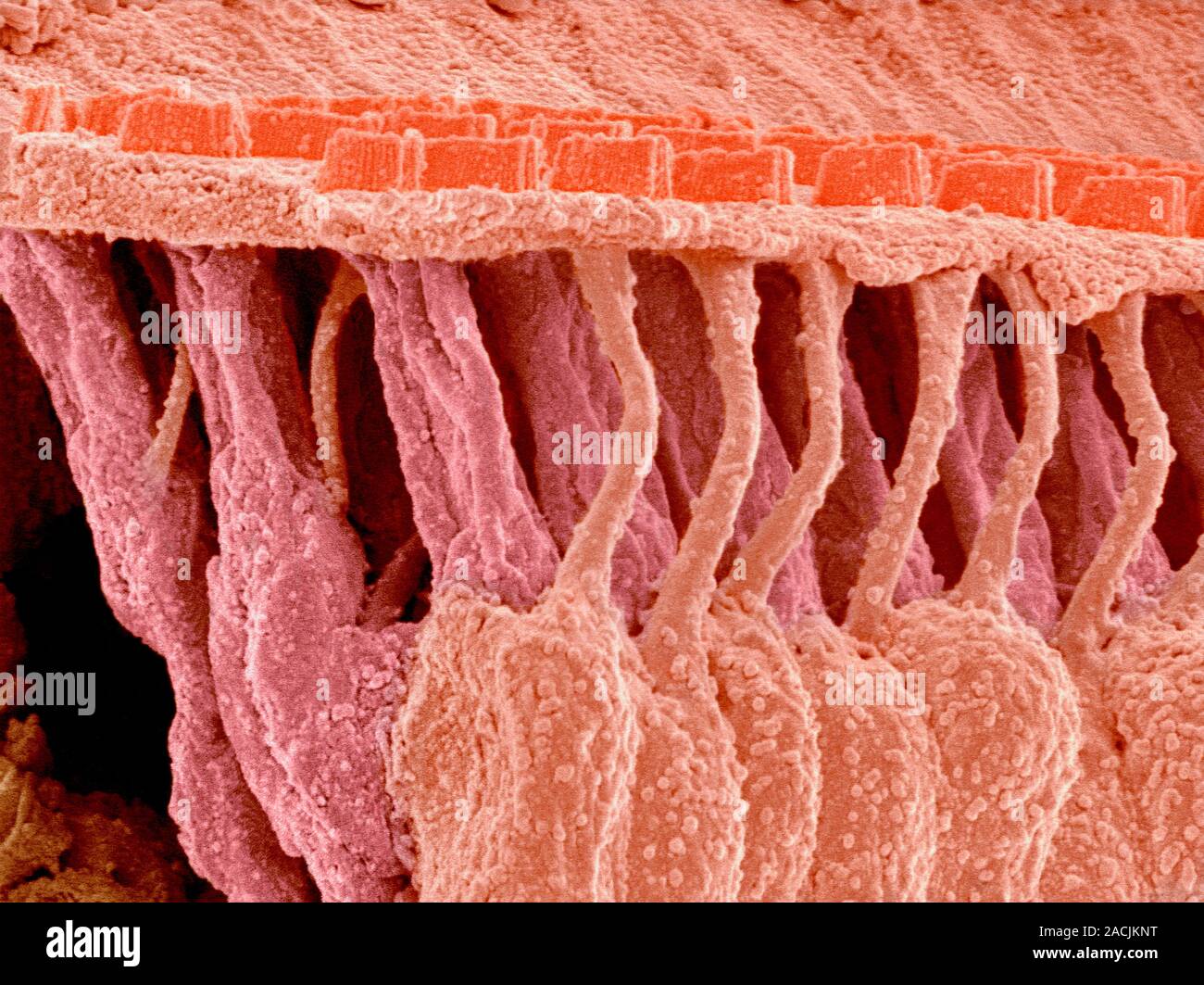 Sensory Hair Cells In Ear Coloured Scanning Electron Micrograph Sem Of Hair Cells In The