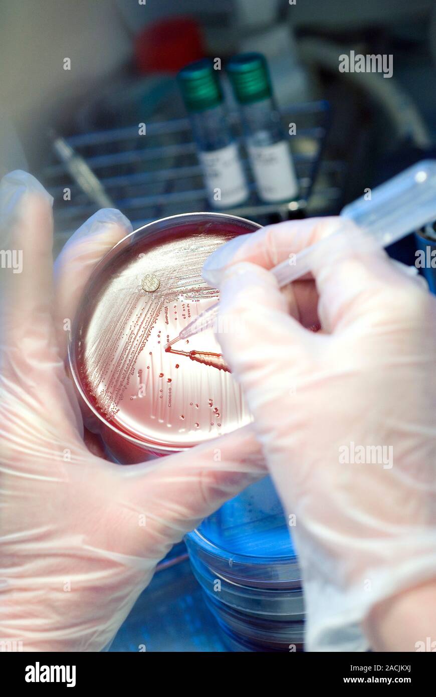 Bacteria research. Technician using a pipette to collect a sample of ...
