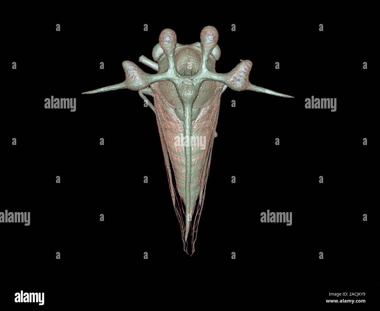 Leafhopper. Three-dimensional reconstruction of a Bocydium globulare ...