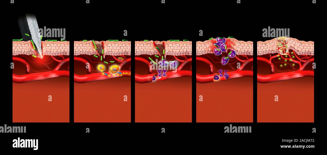 Skin damage immune response. Computer artwork showing the body's immune ...