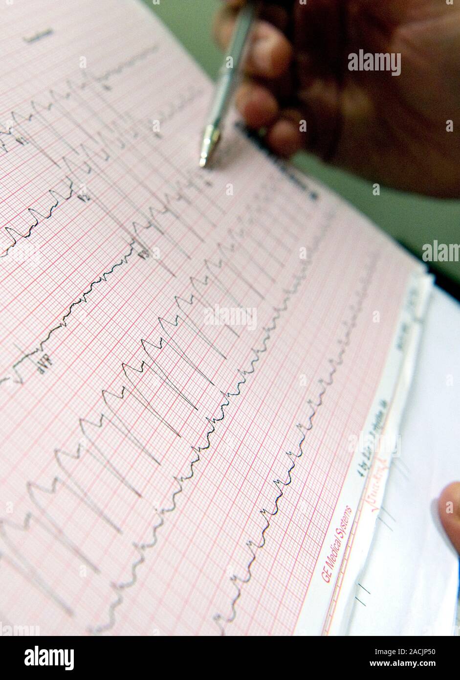 Electrocardiogram analysis. Hands of a doctor analysing the results of ...