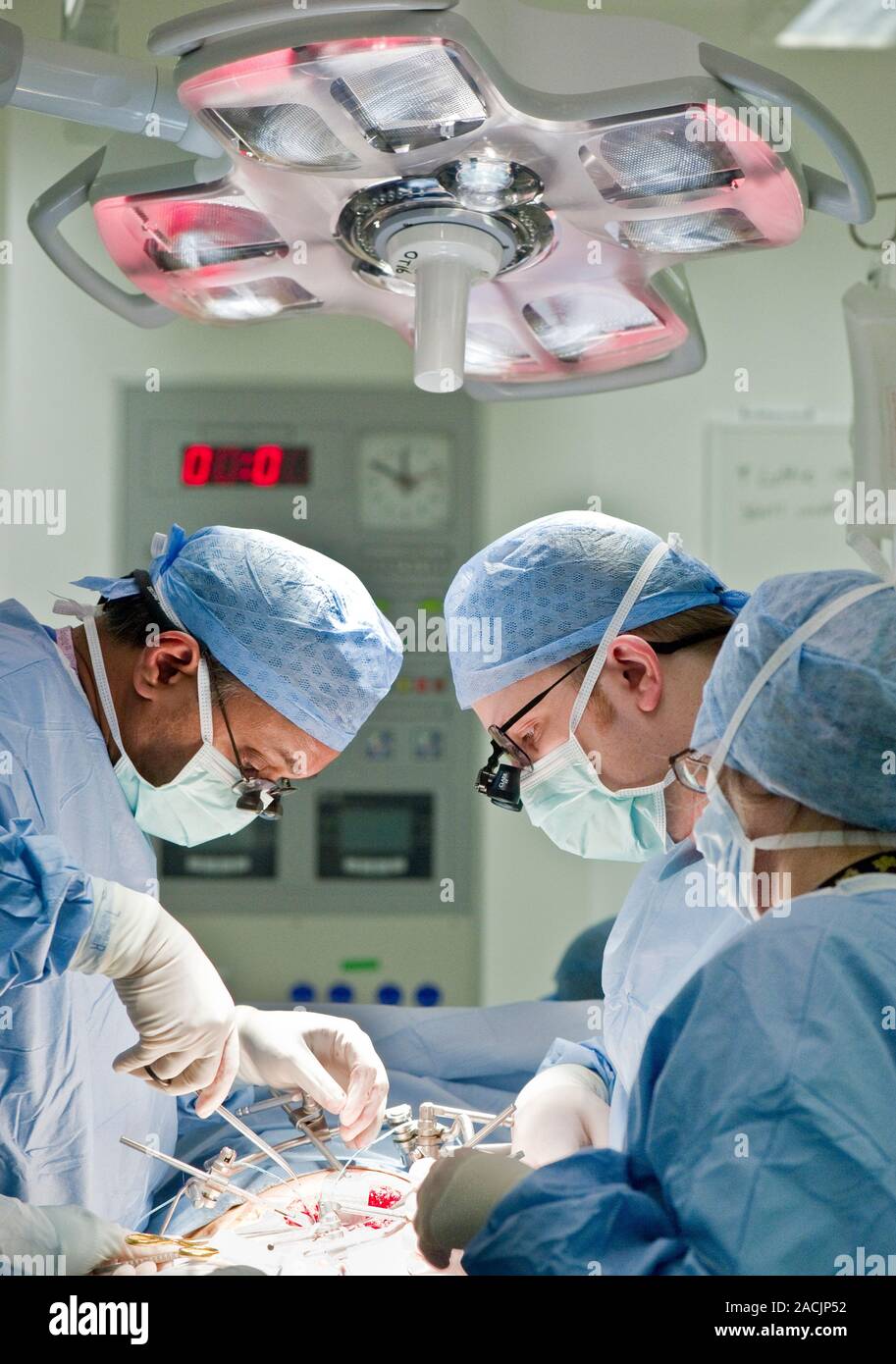 Surgeons operating on a patient in a hospital operating room Stock ...