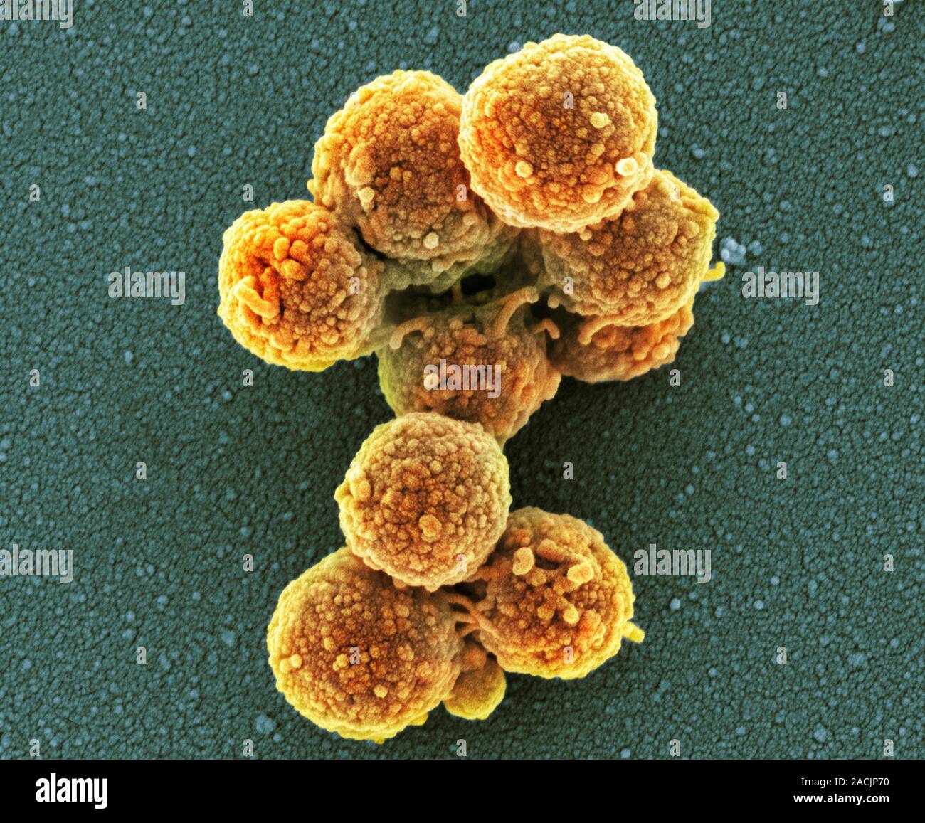 Synthetic Mycoplasma bacteria. Coloured scanning electron micrograph ...