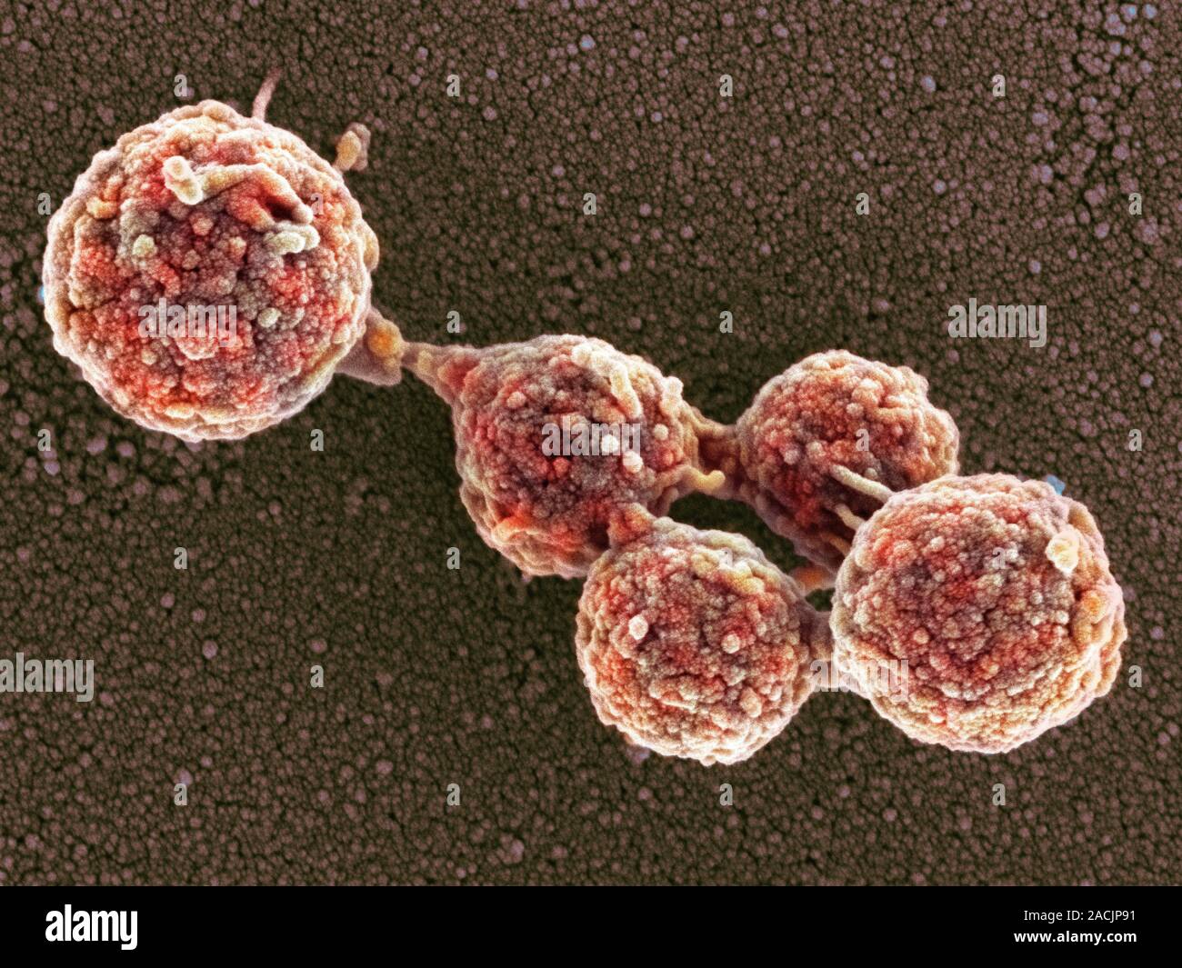 Synthetic Mycoplasma bacteria. Coloured scanning electron micrograph ...