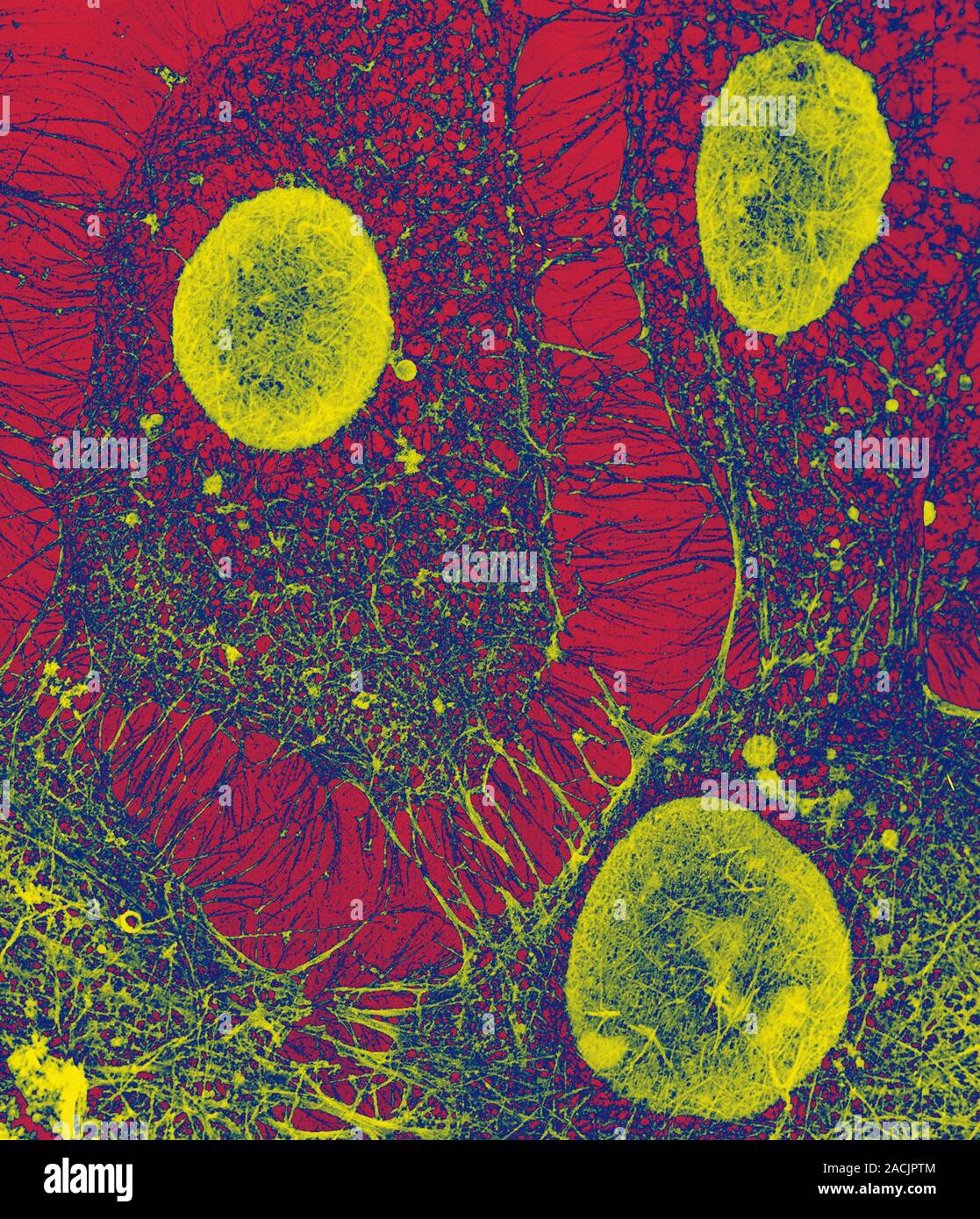 Cytoskeleton. Coloured scanning electron micrograph (SEM) of the ...