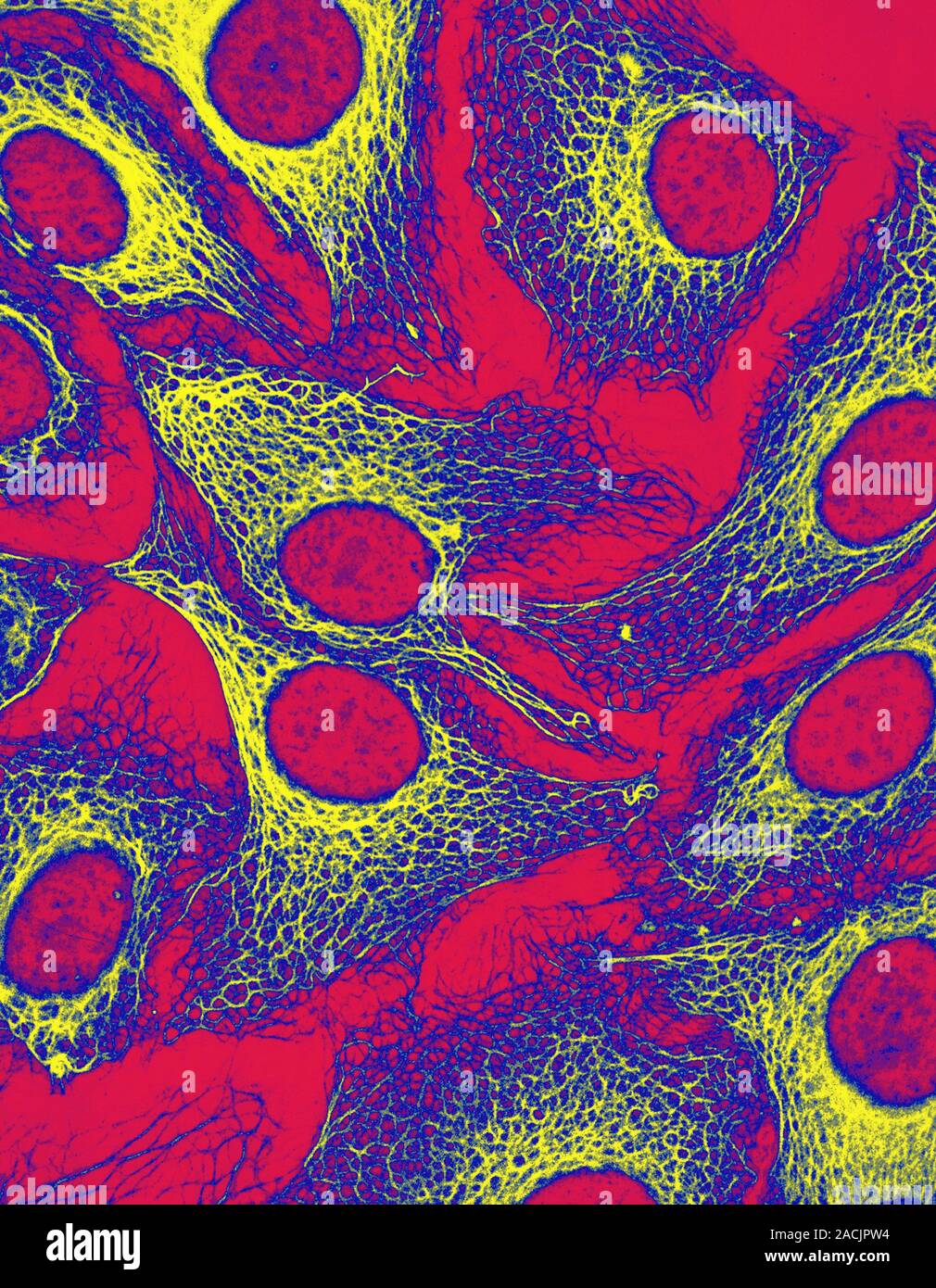 Keratinocyte skin cells. Fluorescent light micrograph of the ...