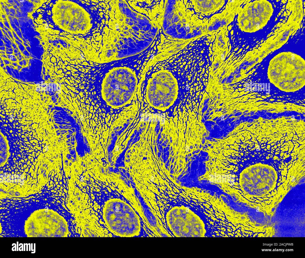 Keratinocyte skin cells. Fluorescent light micrograph of the ...
