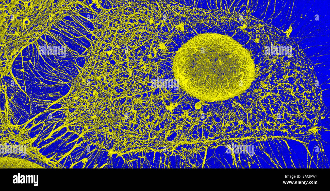 Cytoskeleton. Coloured scanning electron micrograph (SEM) of the ...