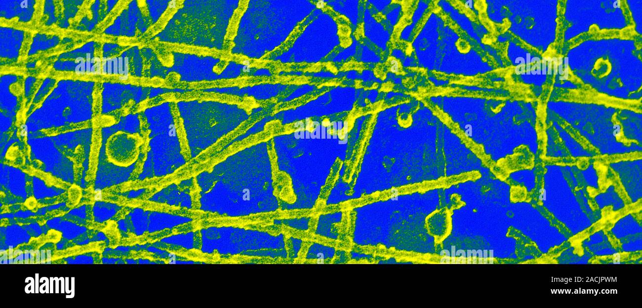 Microtubules. Coloured scanning electron micrograph (SEM) of ...