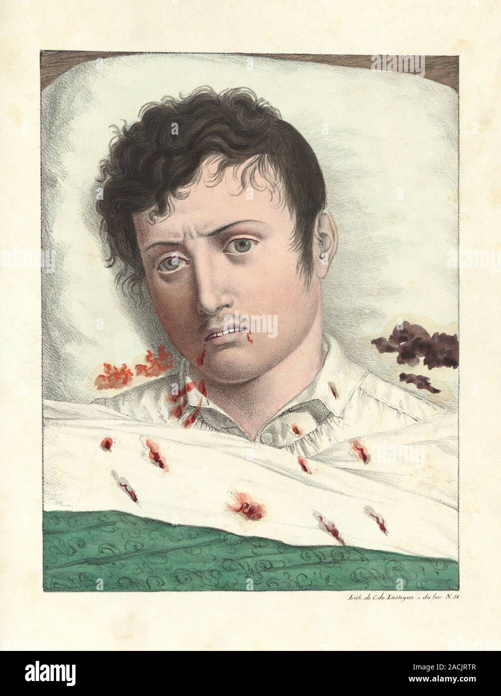 Yellow fever sequence. This portrait, the fourth in a sequence of four ...