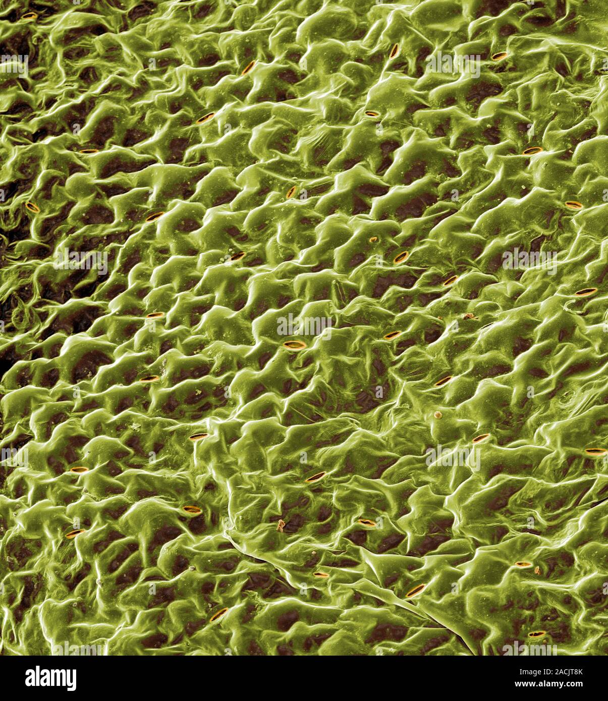 Spinach (Spinacia oleracea), coloured scanning electron micrograph (SEM ...