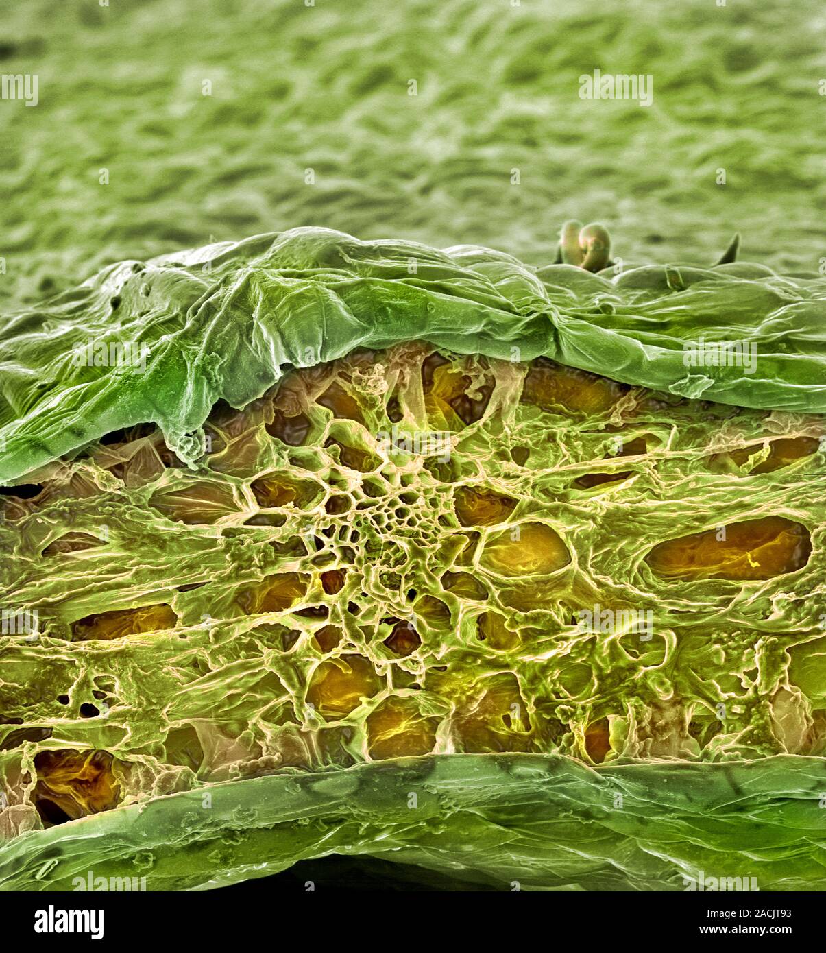 Spinach (Spinacia oleracea), coloured scanning electron micrograph (SEM ...