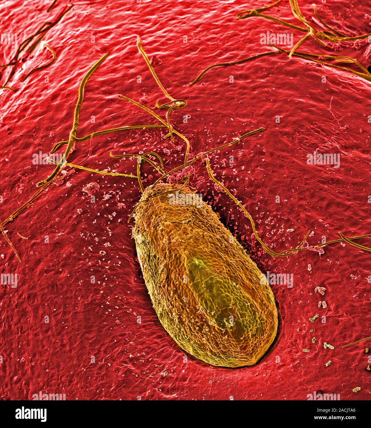 Strawberry (Fragaria sp.), coloured scanning electron micrograph (SEM ...