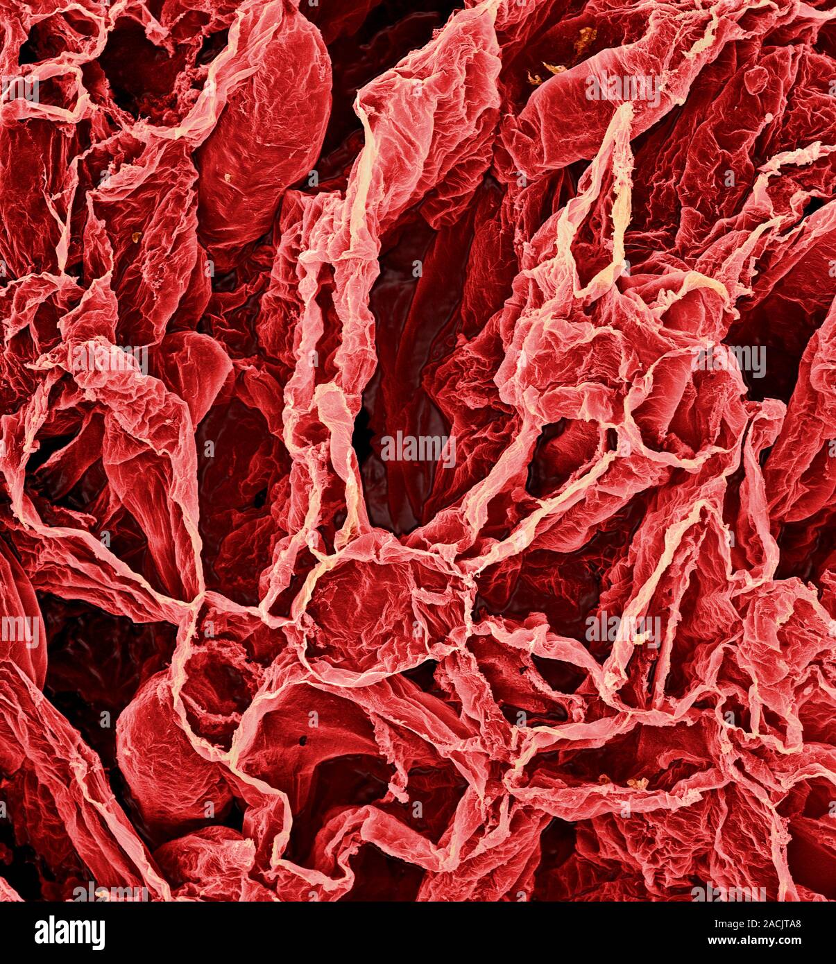 Strawberry (Fragaria sp.), coloured scanning electron micrograph (SEM ...