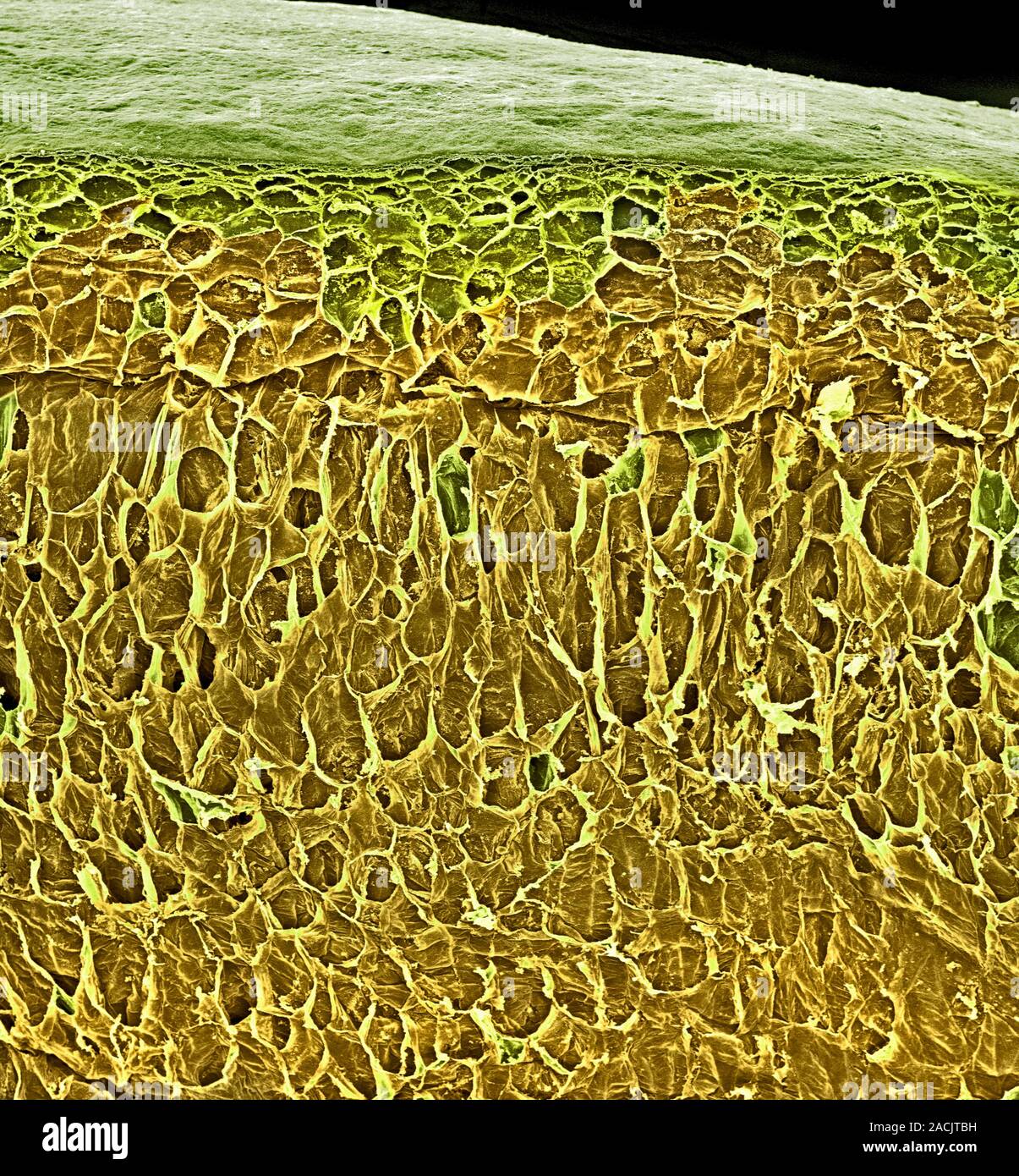 White grape (Vitis sp.), coloured scanning electron micrograph (SEM ...