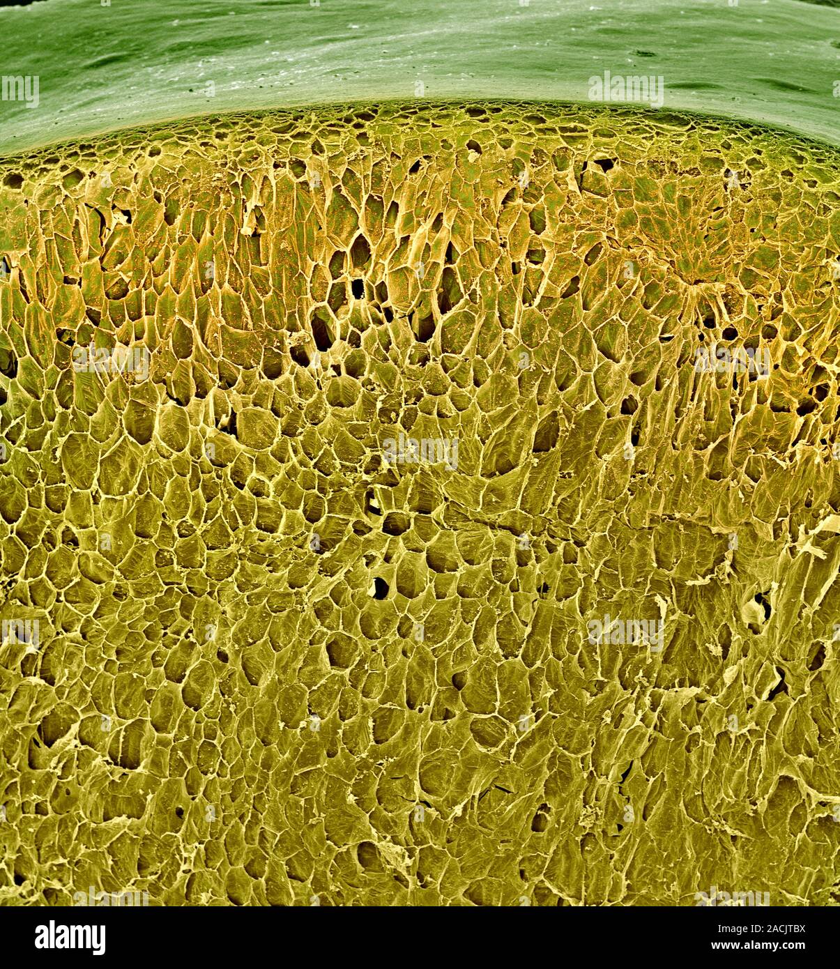 White grape (Vitis sp.), coloured scanning electron micrograph (SEM ...