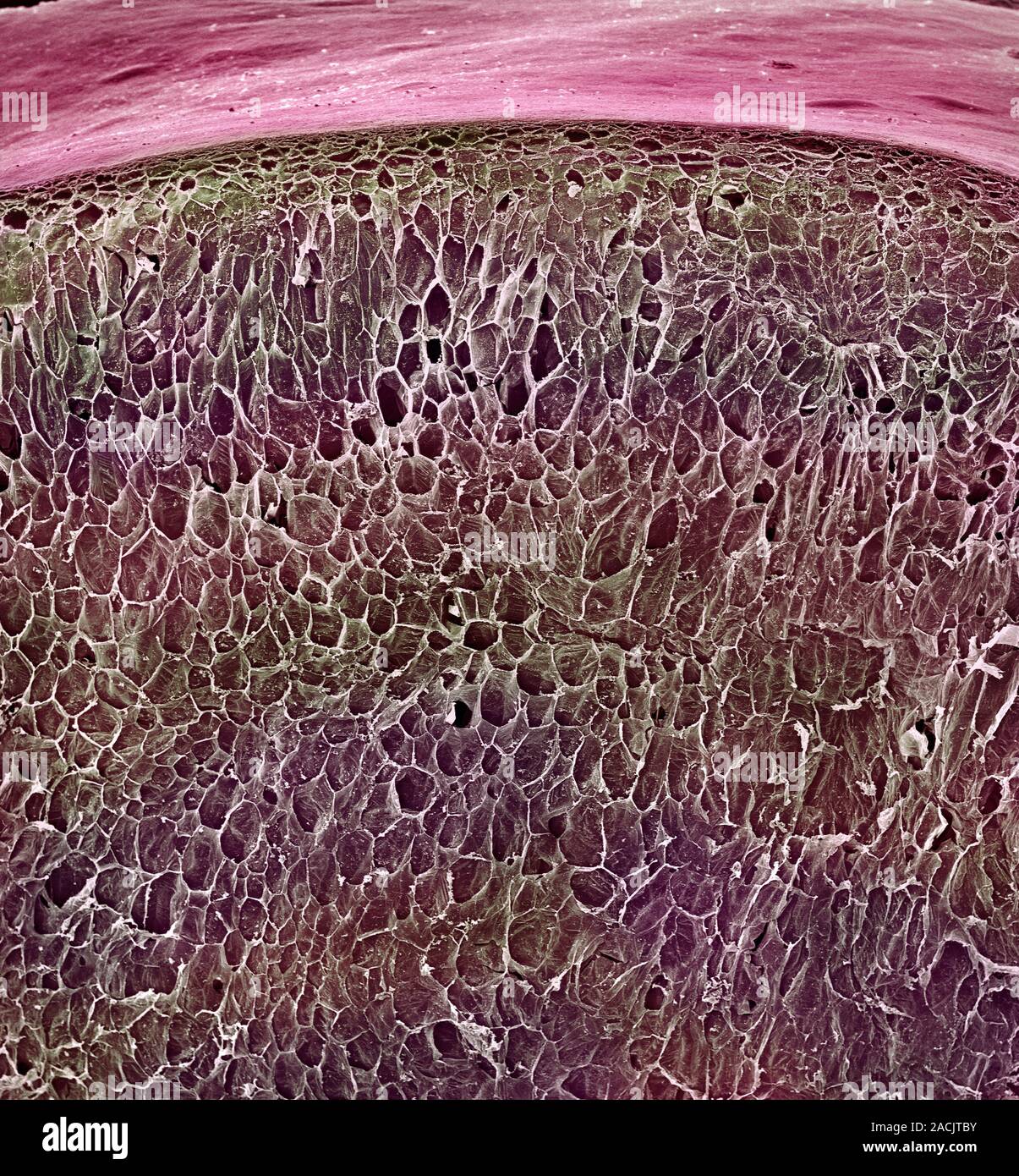 Red grape (Vitis sp.), coloured scanning electron micrograph (SEM Stock ...