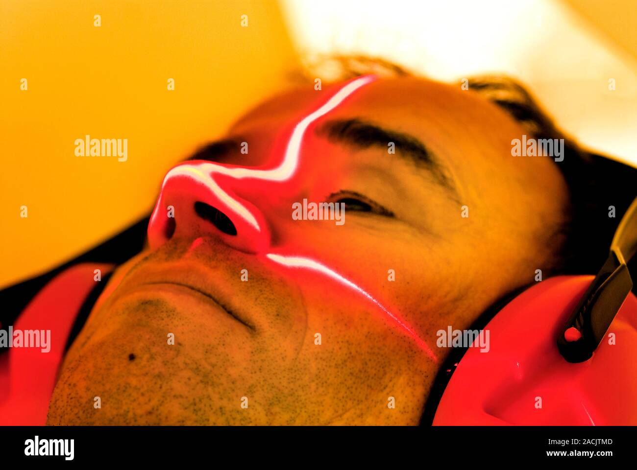 Autism research. Man with autism undergoing a functional magnetic ...