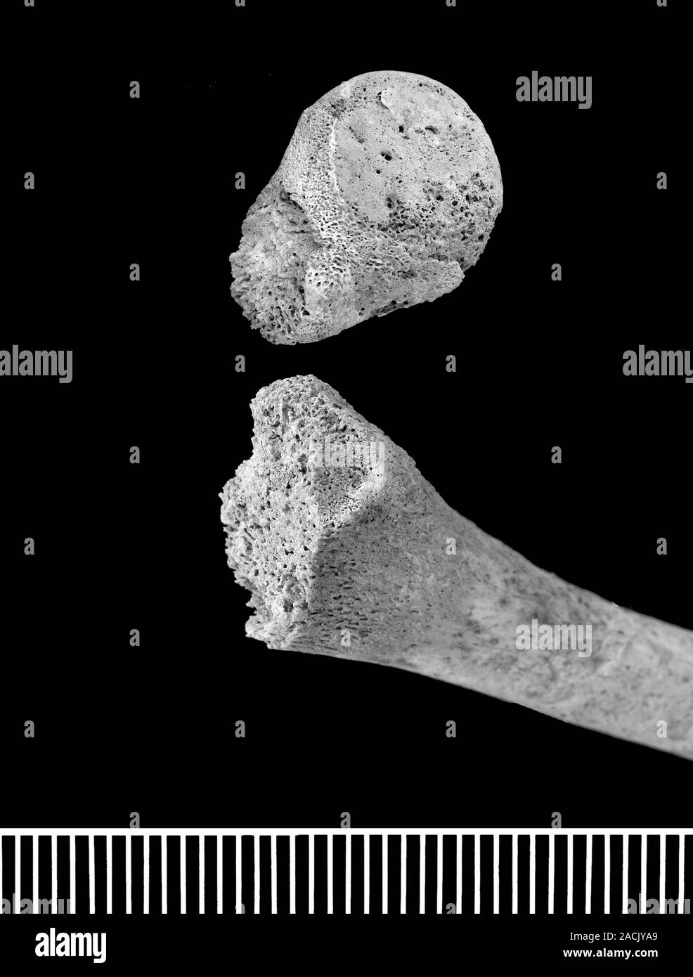 Infant bones from Roman Britain. Museum collection of bones from a ...