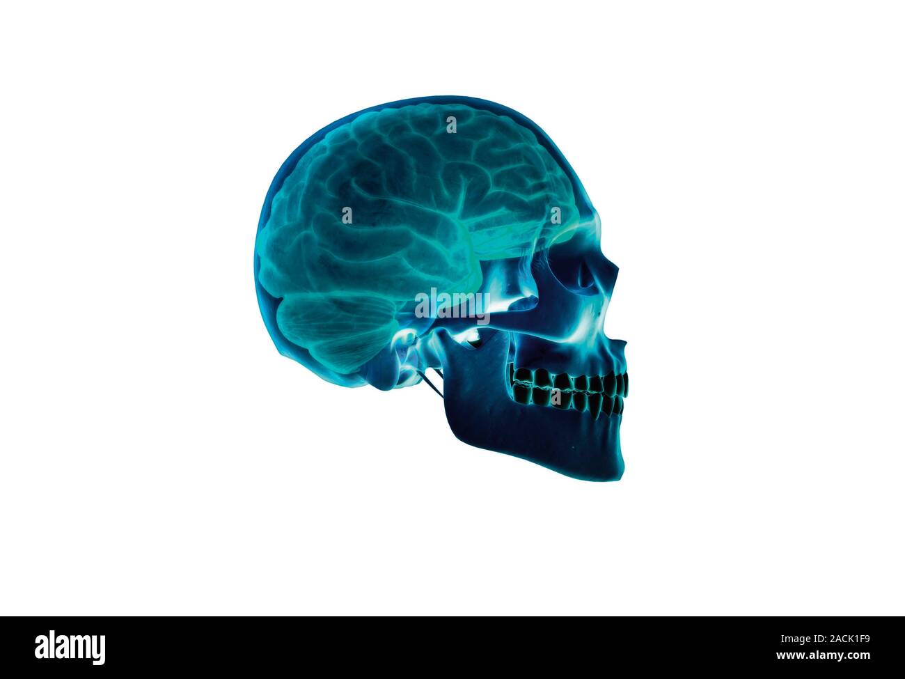 Brain and skull. Artwork of a human brain (green) within its skull ...