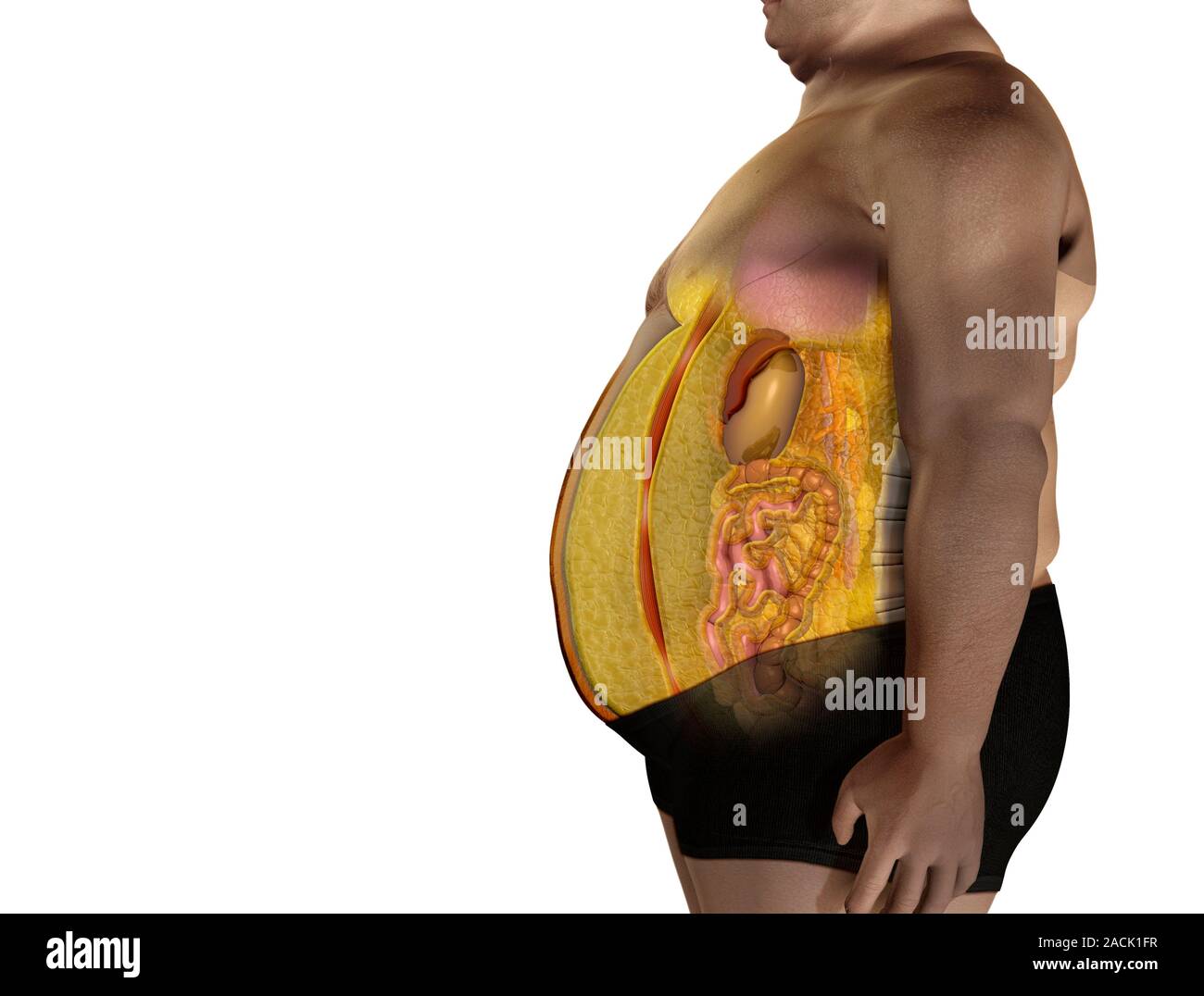 Fat on inner organs. Artwork showing the internal distribution of fat ...