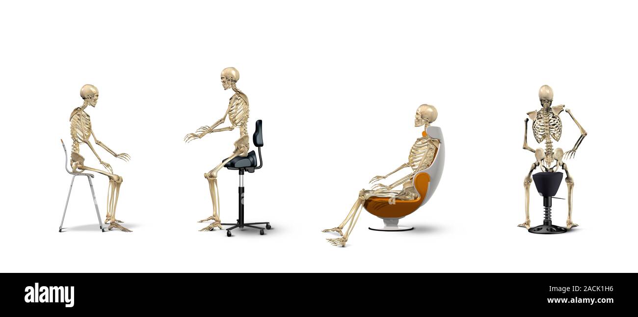 Chair ergonomics. Series of artworks of human skeletons, showing the ...