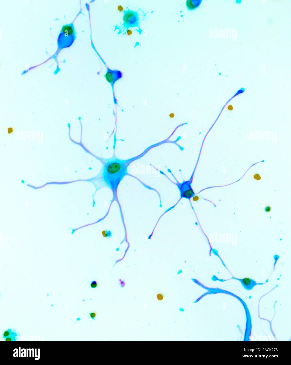 Foetal brain cells. Fluorescence light micrograph of isolated neurons ...