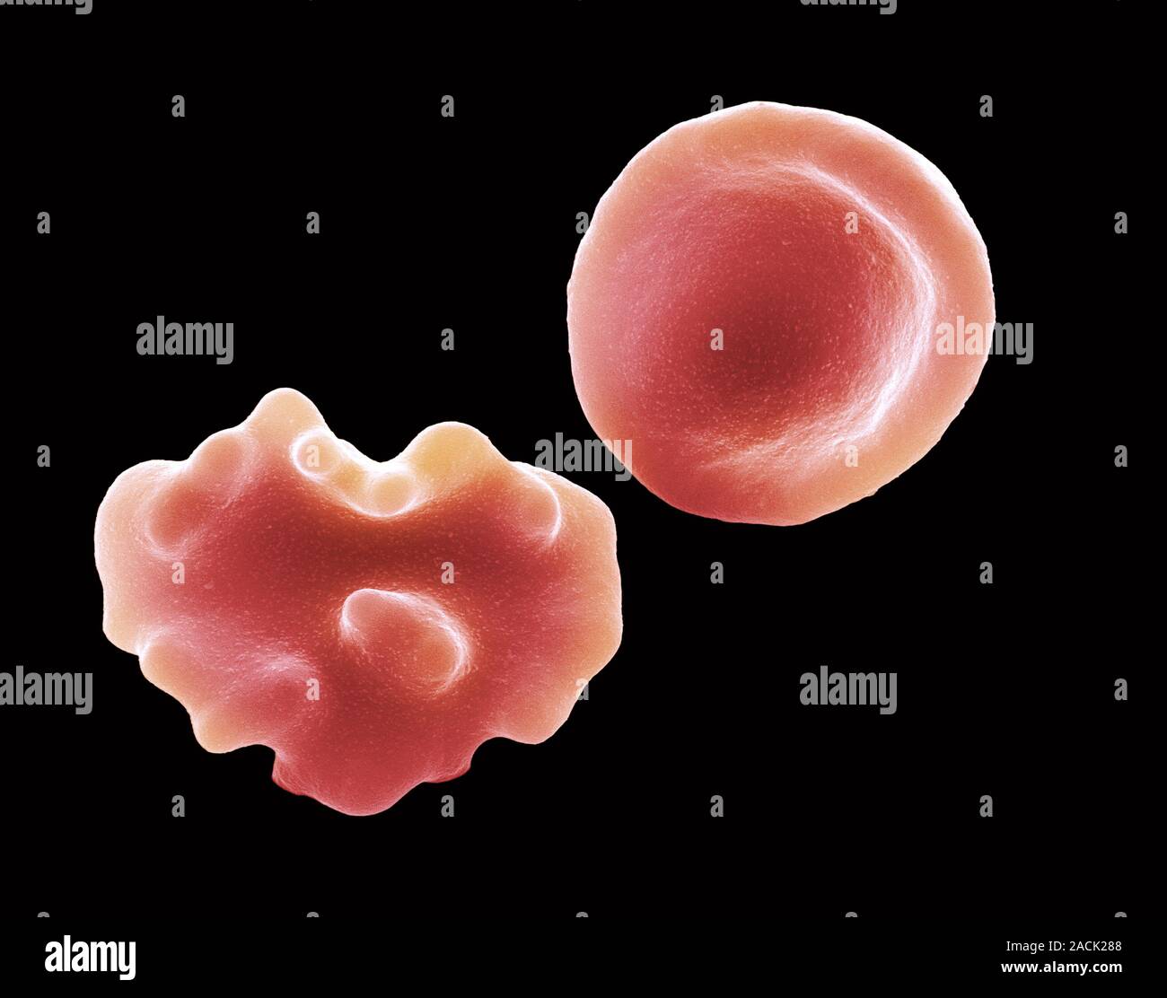 Red blood cells. Coloured scanning electron micrograph (SEM) of a ...