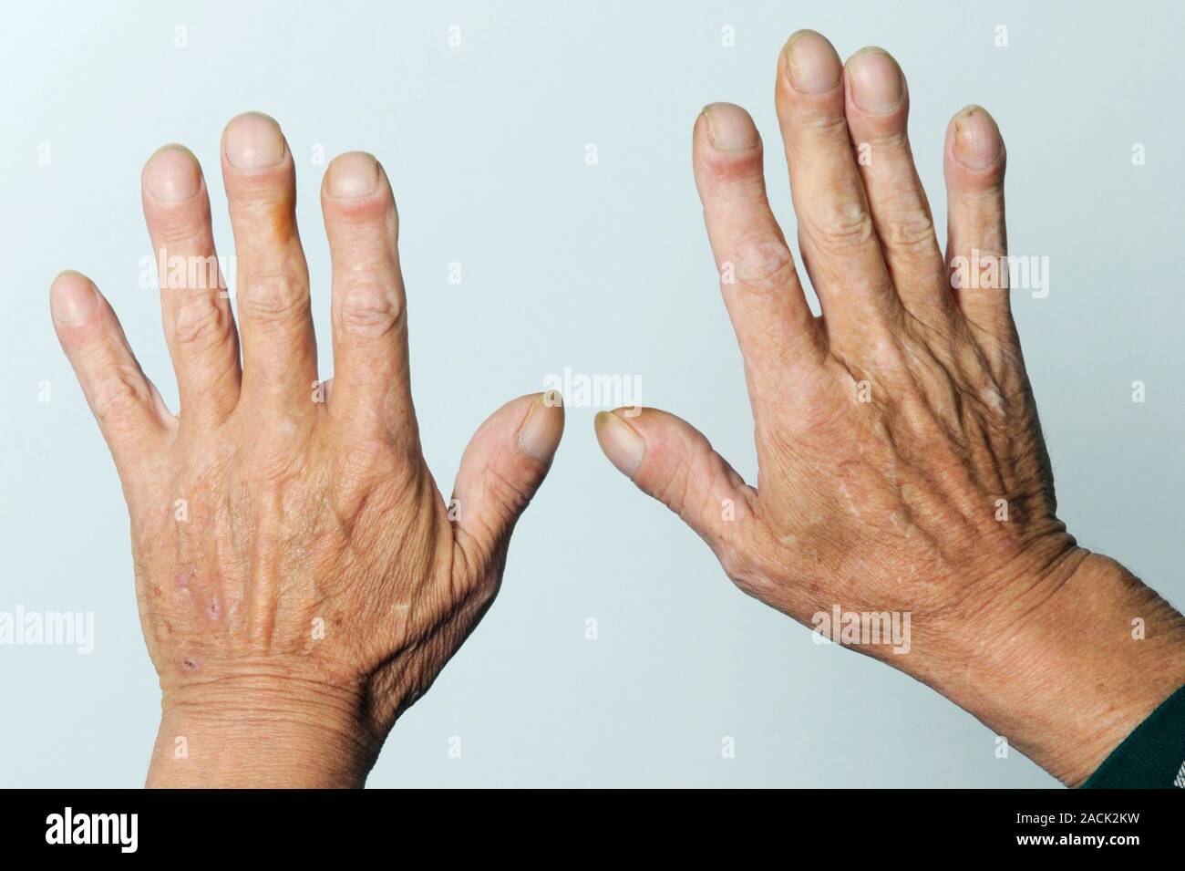 Not for use in Television Not for use in Television Hands showing ...