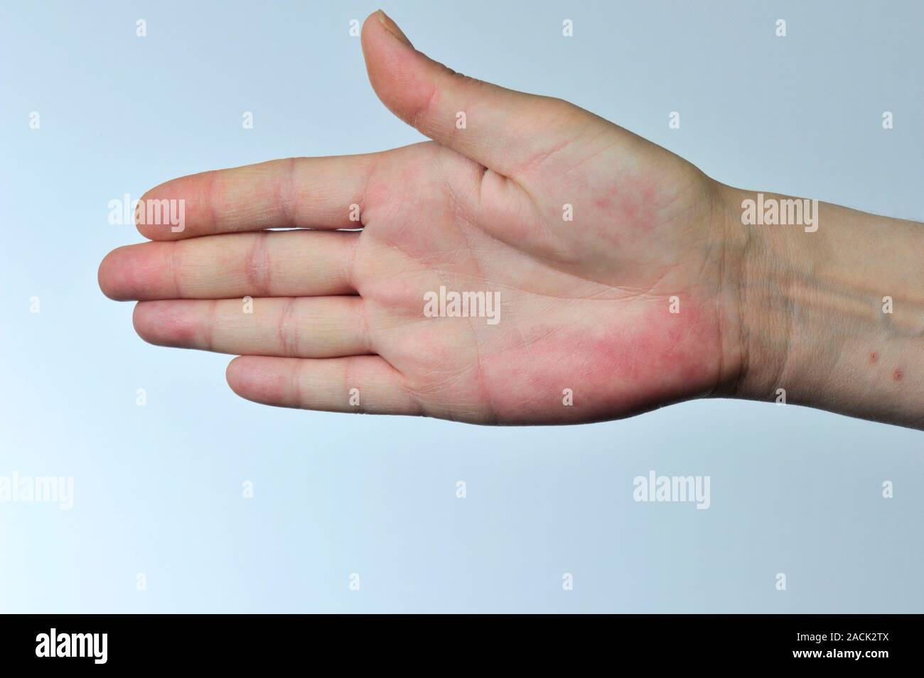 Not for use in Television Not for use in Television Palm of the hand in ...